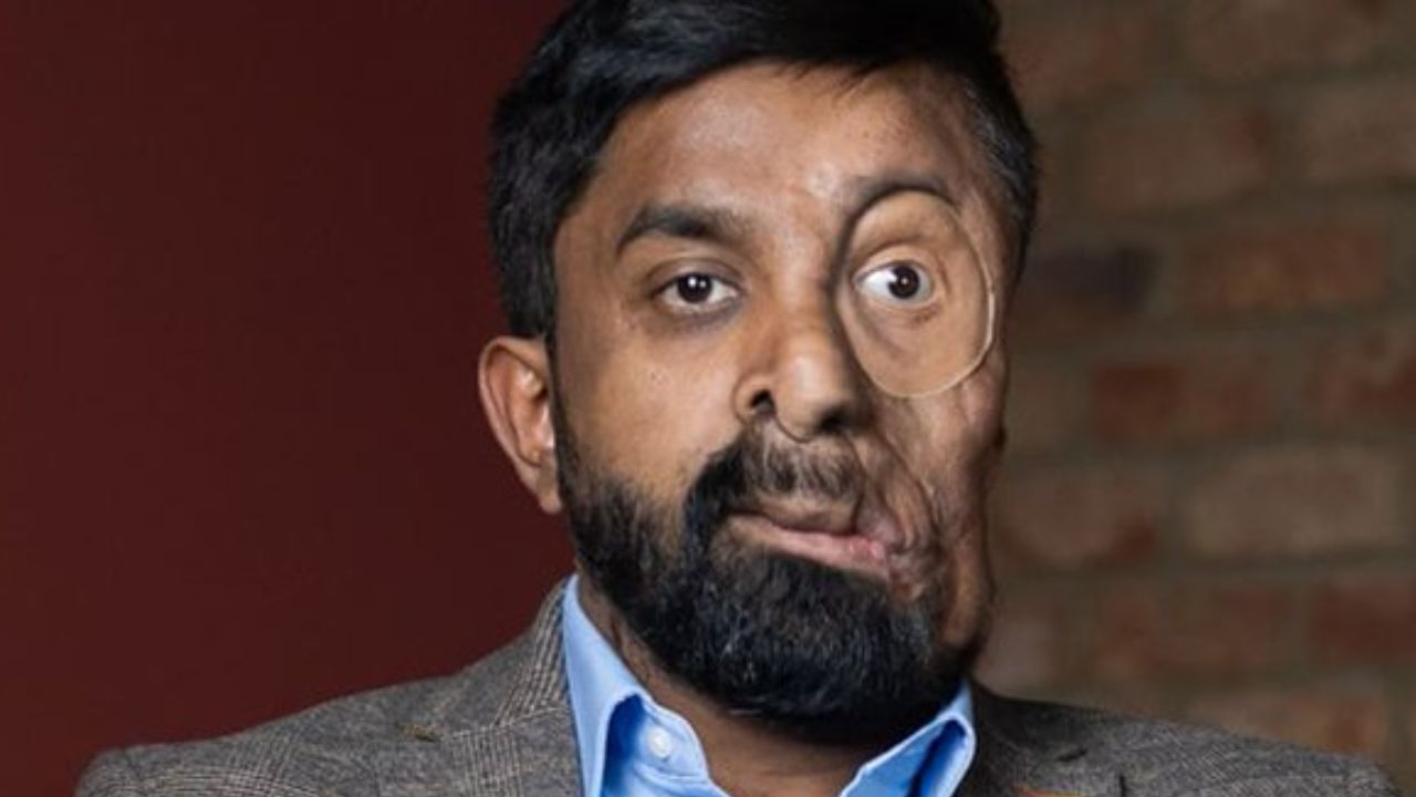 अरे तुम तो भूत... बीमारी के कारण लंदन में भारतीय से भेदभाव, आत्मविश्वास ...